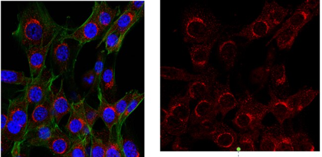 MilliporeSigma E2F-7, Mouse, Unlabeled, Clone: 14C3.2, 100μg; Unlabeled:Antibodies | Fisher ...